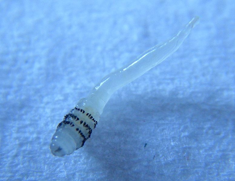 Try Popping this Parasitic Pimple – The Quad